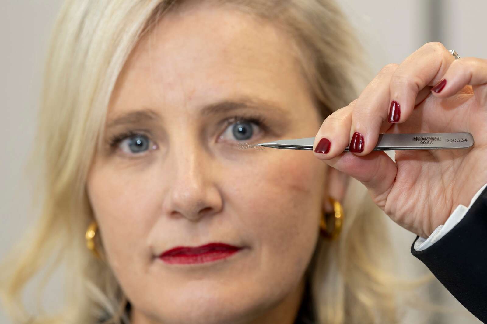 Galway medtech firm raises €6.4m for stroke prevention device ...